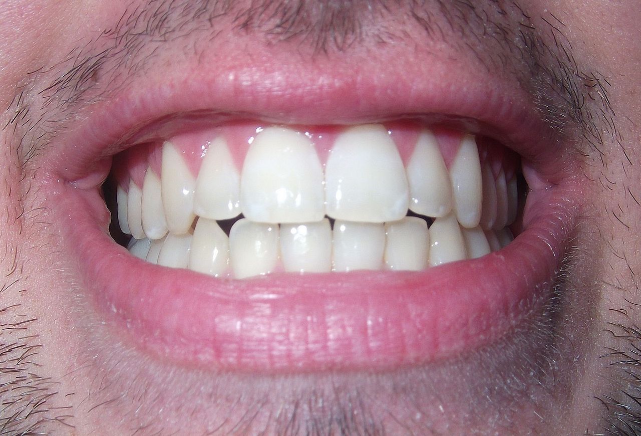 EVASION - L'attente pour prendre soin de ses dents a peu varié dans les ...